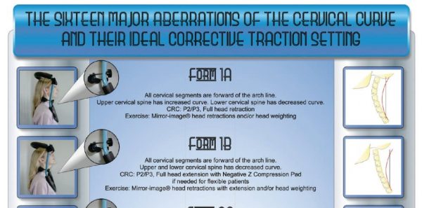 The 16 Major Aberrations of the Cervical Curvature - Circular Traction